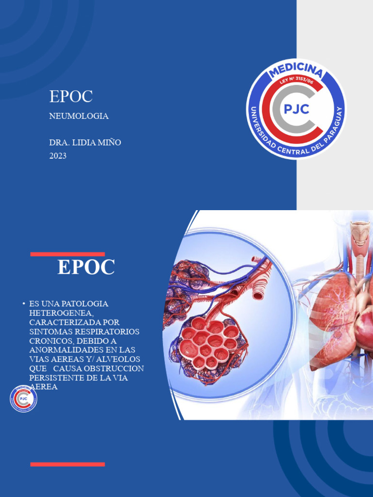Epoc Clase | PDF