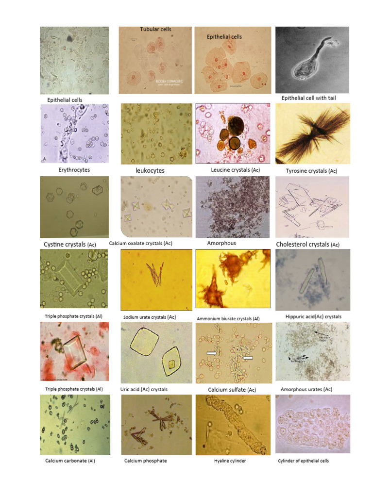 Atlas Urine | PDF | Sistema genitourinario | Fluidos corporales