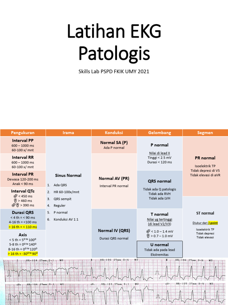 Latihan EKG 2 Mahasiswa | PDF