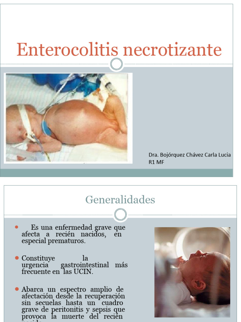 Enterocolitis Necrotizante | PDF | Especialidades Medicas | Ciencias de ...