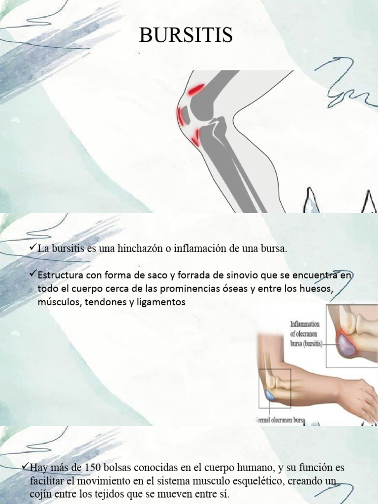 Bursitis: Causas y Tratamientos | PDF | Rodilla | Especialidades Medicas