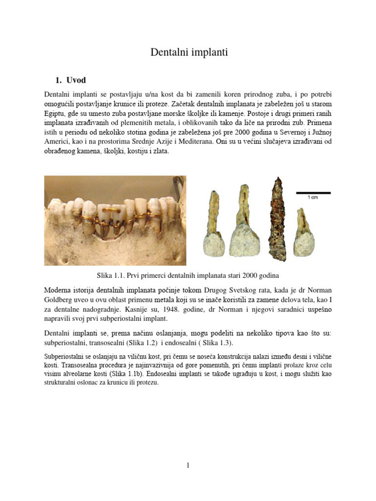 Lekcija 2.2 - Dentalni Implanti | PDF