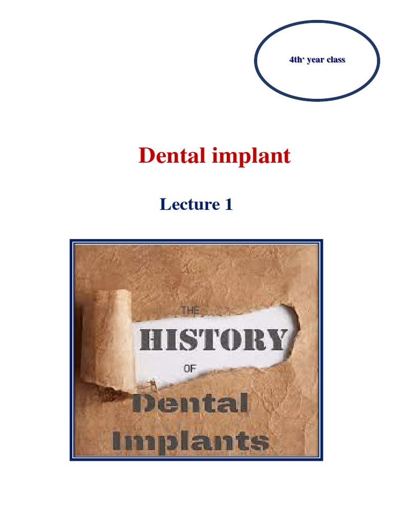 Dental Implant | PDF | Dental Implant | Dentistry