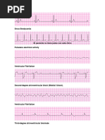 Advanced Life Support ALS Practice Questions MCQ Mock Paper 1 of 12 ...