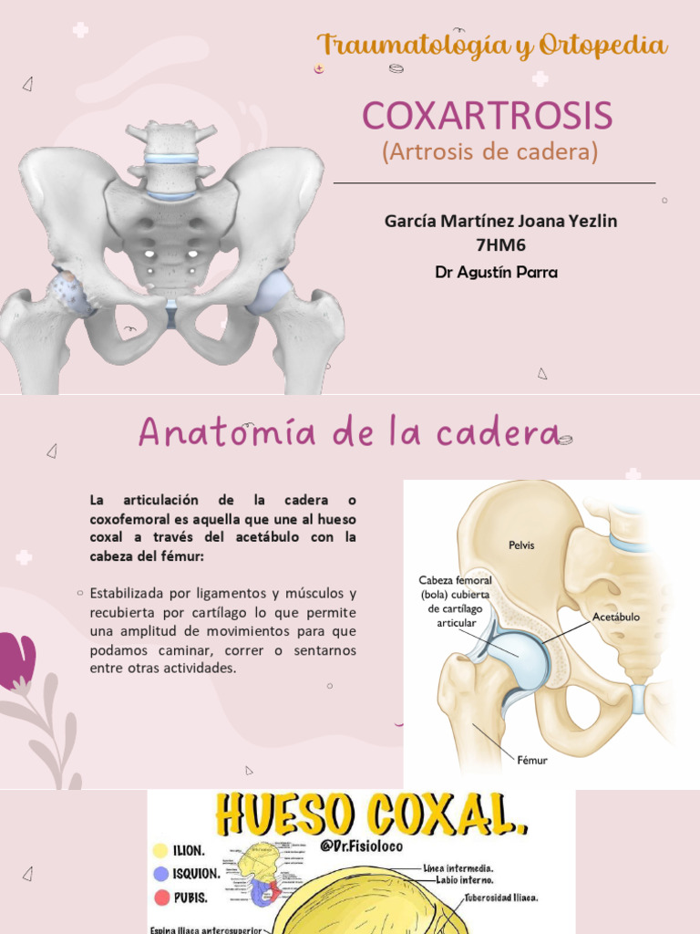 COXARTROSIS | PDF | Rodilla | Articulación