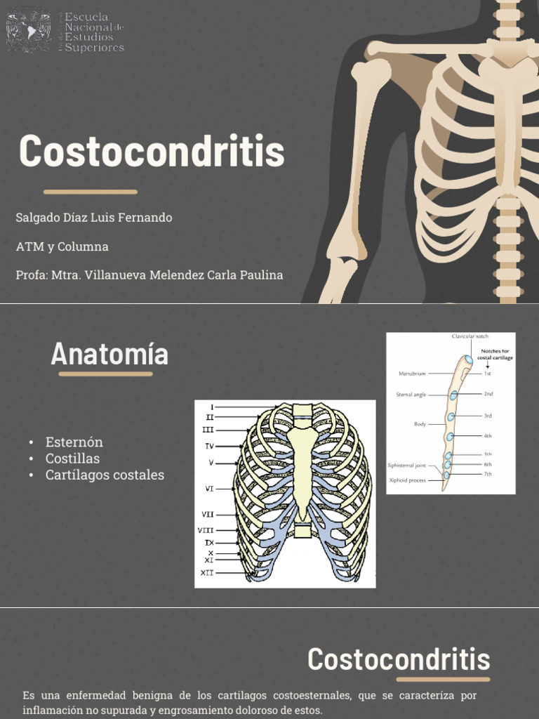 Costocondritis | PDF | Tórax | Causas de la muerte
