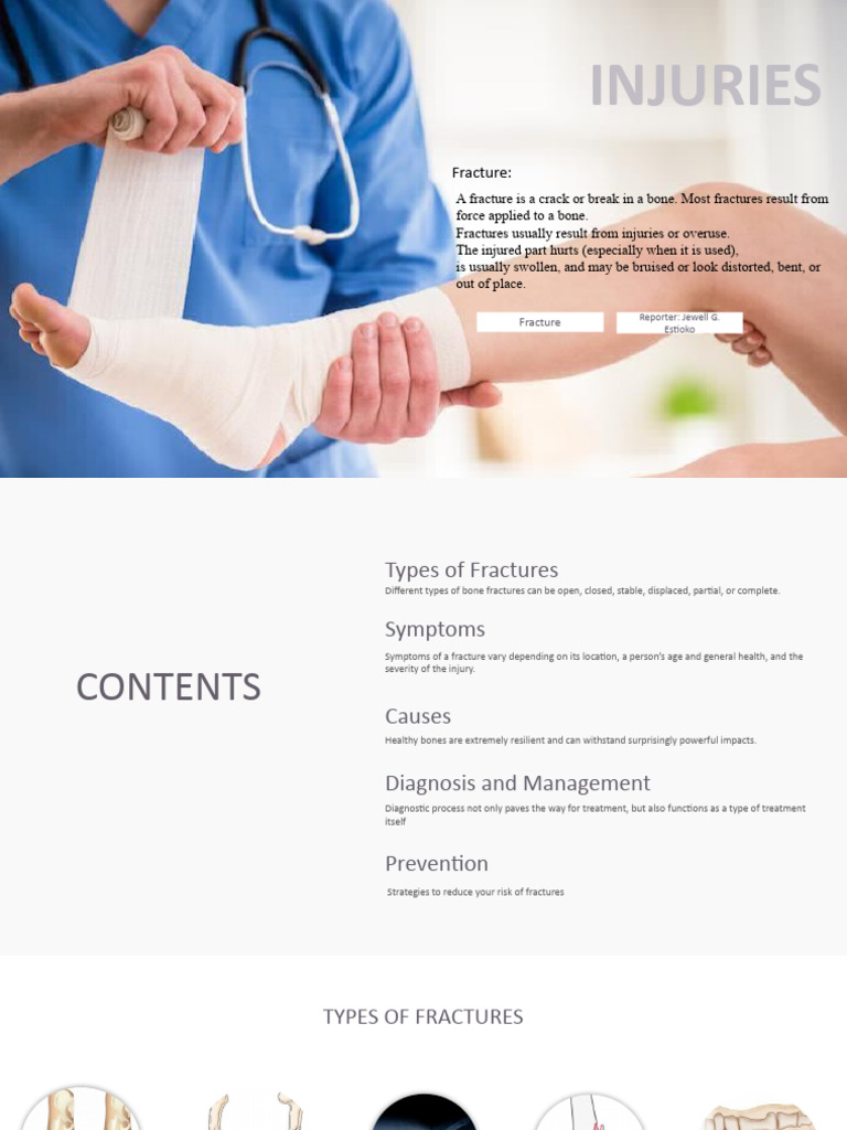 Estioko Fracture | PDF | Bone | Injury