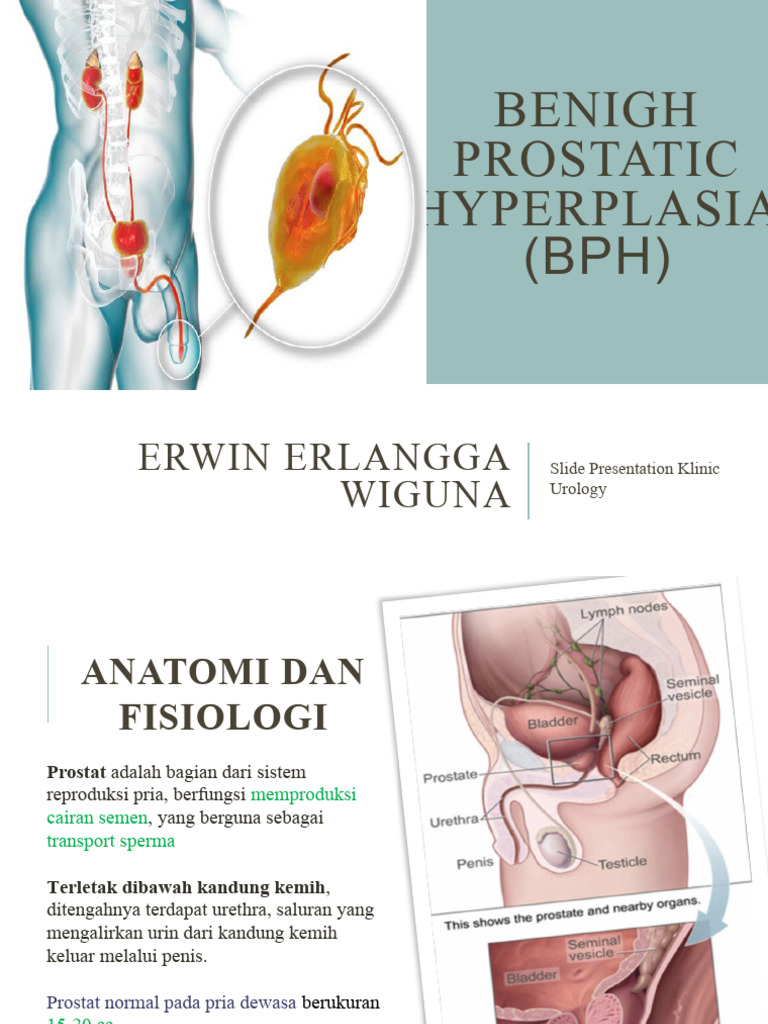 Slide BPH | PDF | Kesehatan Holistik | Sains & Matematika