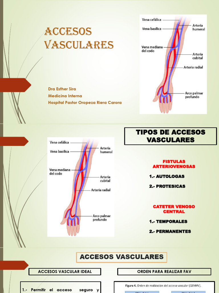 Accesos Vasculares Resumido PDF | PDF | Hemodiálisis | Especialidades Medicas