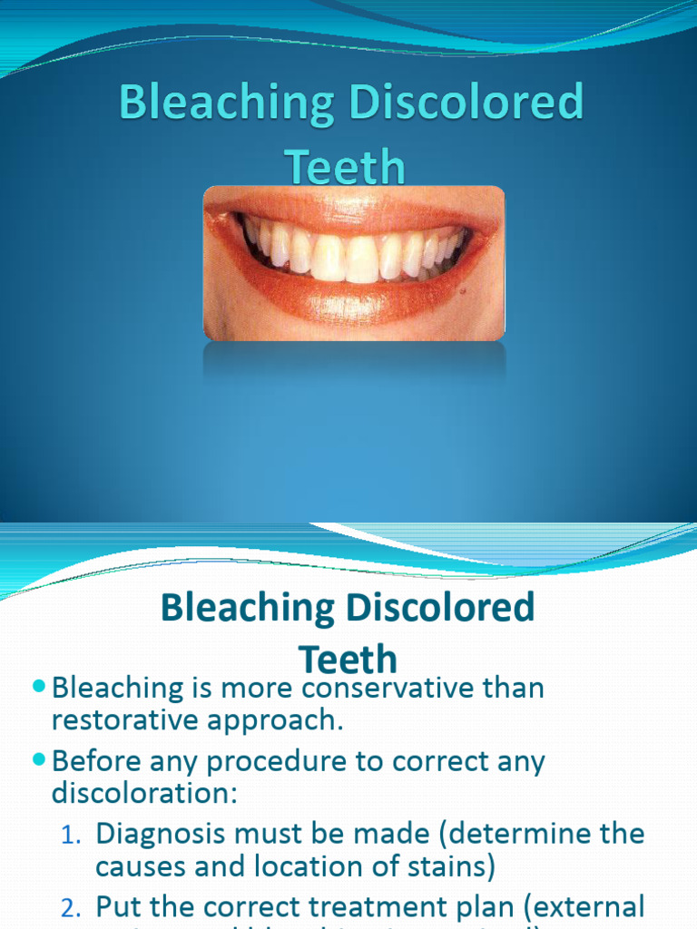 Bleaching Pdf Tooth Enamel Dentin