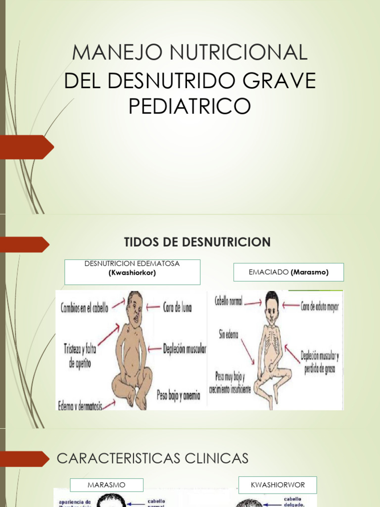 Manejo Nutricional Desnutrido Grave | PDF | Hierro | Potasio