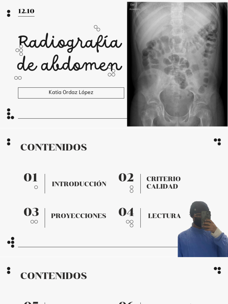 Radiografía de Abdomen y Coprostasis | PDF | Sistema urinario ...
