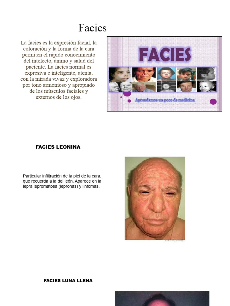 Tipos de Facies en Medicina | PDF | Salud y bienestar