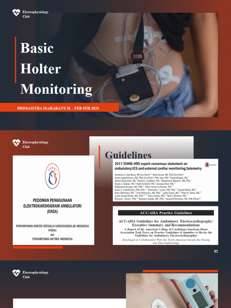EP Club - Basic Holter Monitoring | PDF | Cardiac Electrophysiology | Electrocardiography