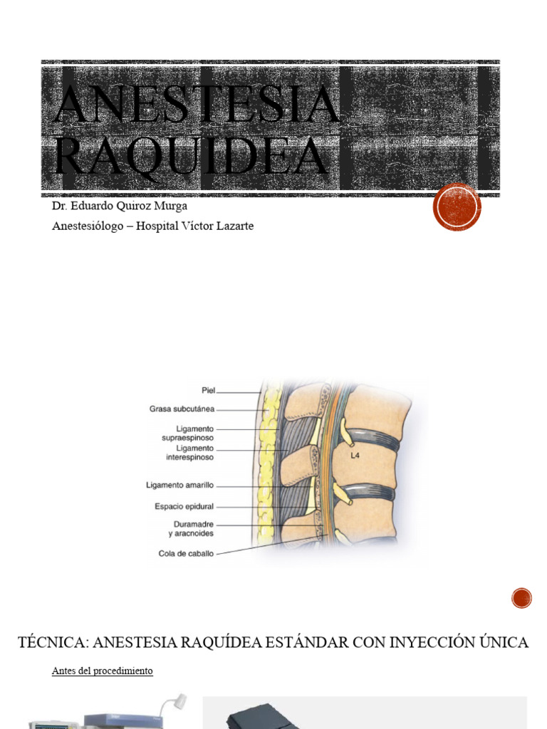 Anestesia Raquidea | PDF | Anestesia | Farmacología
