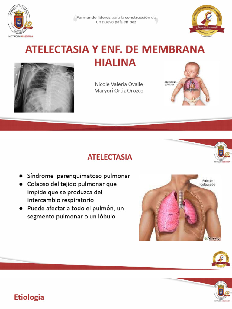 Atelectasia y EMH | PDF | Pulmón | Medicina