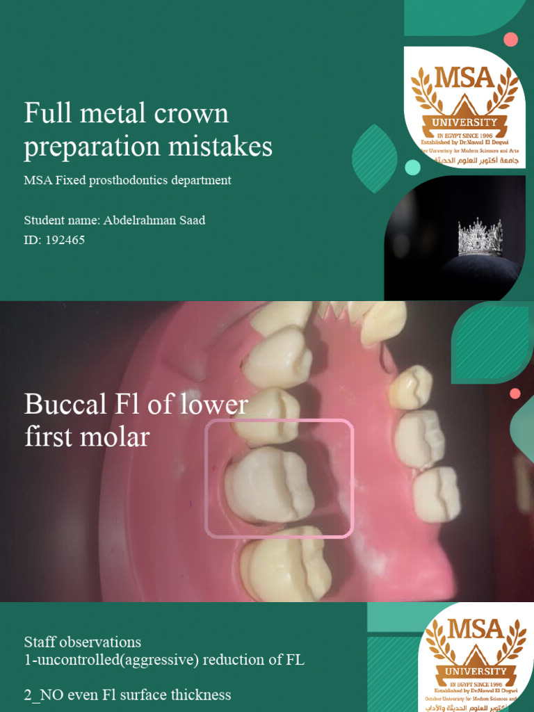 Full Metal Crown Preparation Mistakes | PDF | Career & Growth ...