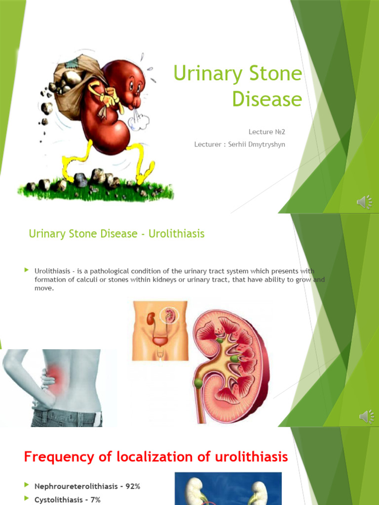 Urolithiasis | Download Free PDF | Urinary System | Kidney