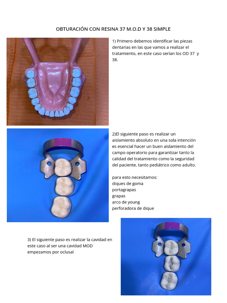 37 Mod y 38 | PDF | Diente | Odontología