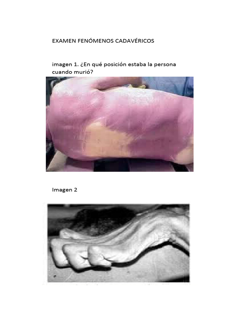 Fenómenos Cadavéricos Tempranos | PDF | Arte