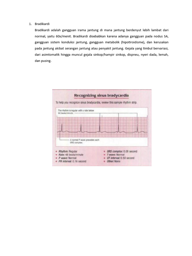 Irama Jantung | PDF | Perjalanan | Kesehatan Holistik