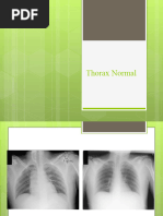 Radiologi Thorax Normal | PDF
