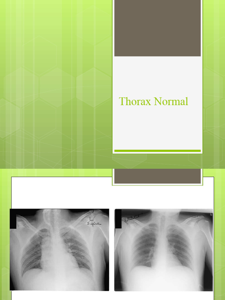 Chest X Ray | PDF | Clinical Medicine | Medical Specialties