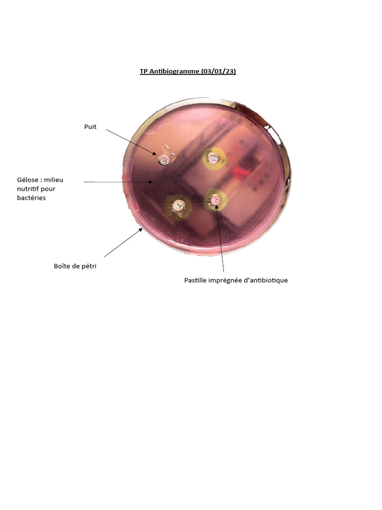 TP Antibiogramme Paslas | PDF