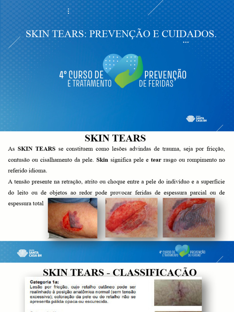 Prevenção de Lesões: Skin Tears | PDF