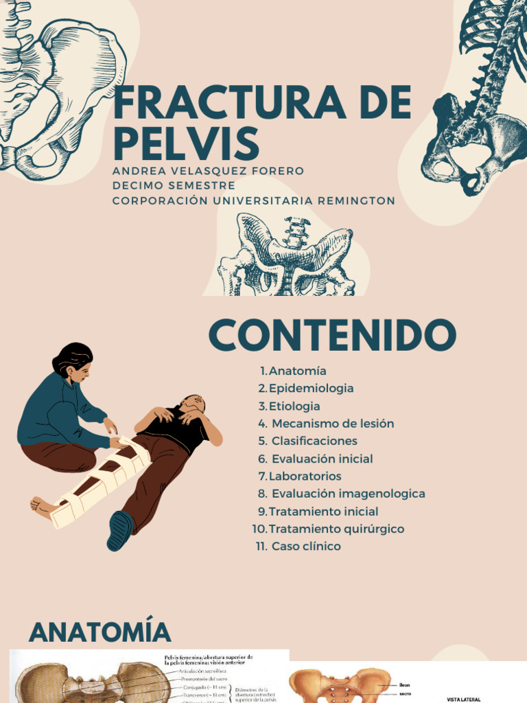 Fractura Pelvis Pdf Pelvis Lesión