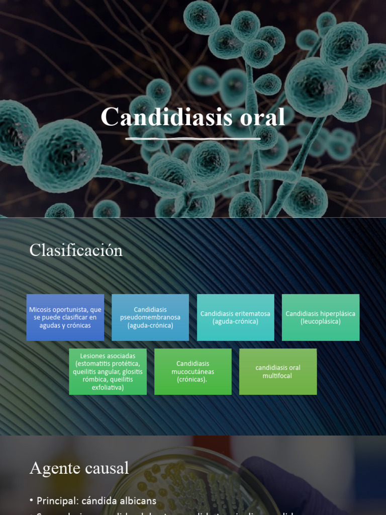 Candidiasis Oral | PDF | Candidiasis | Tinción