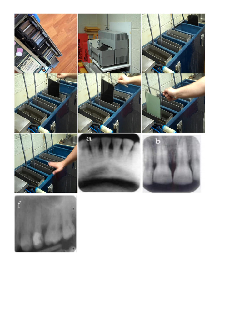 Lampiran Radiografi Pencucian Film | PDF