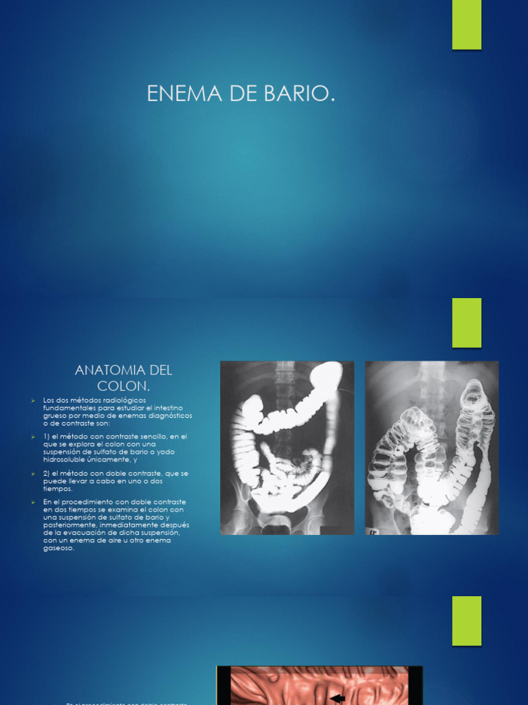 Enema de Bario | PDF | Intestino grueso | Gastroenterología