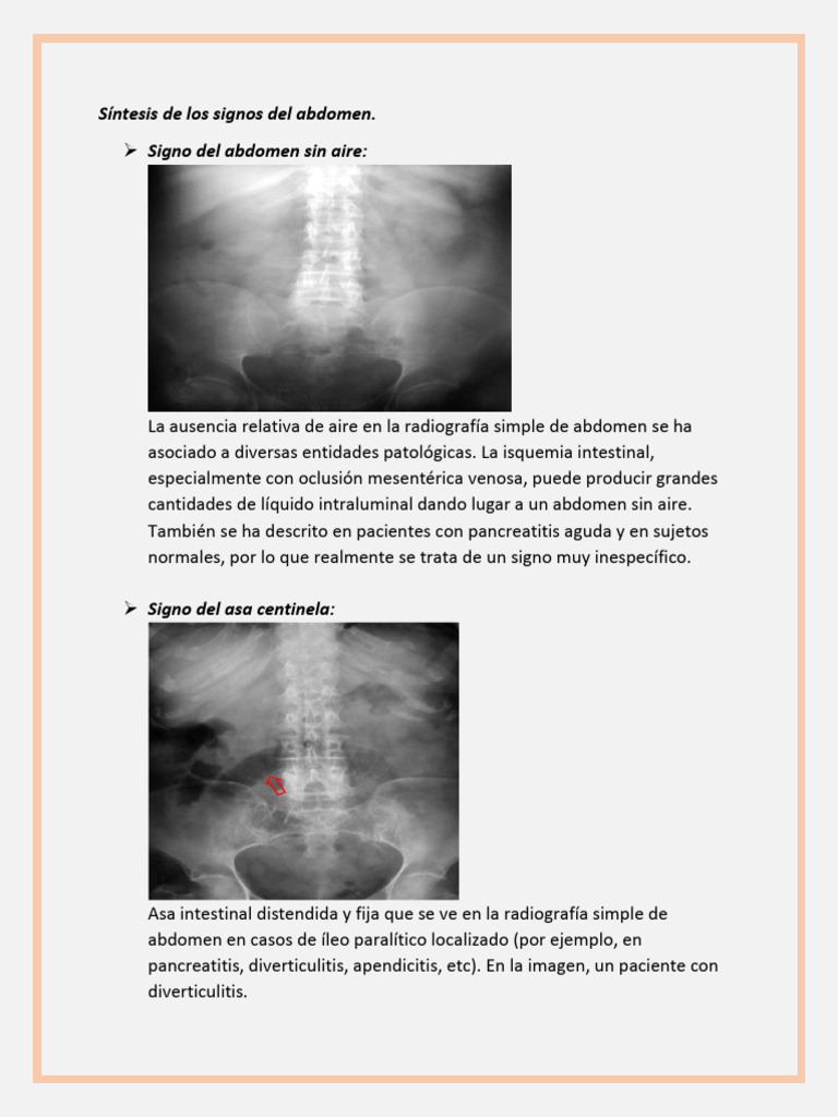 Signos Radiológicos del Abdomen | PDF | Tracto gastrointestinal | Abdomen