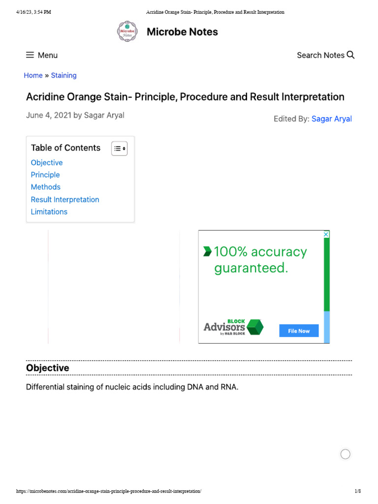 Acridine Orange Stain - Principle, Procedure and Result Interpretation ...
