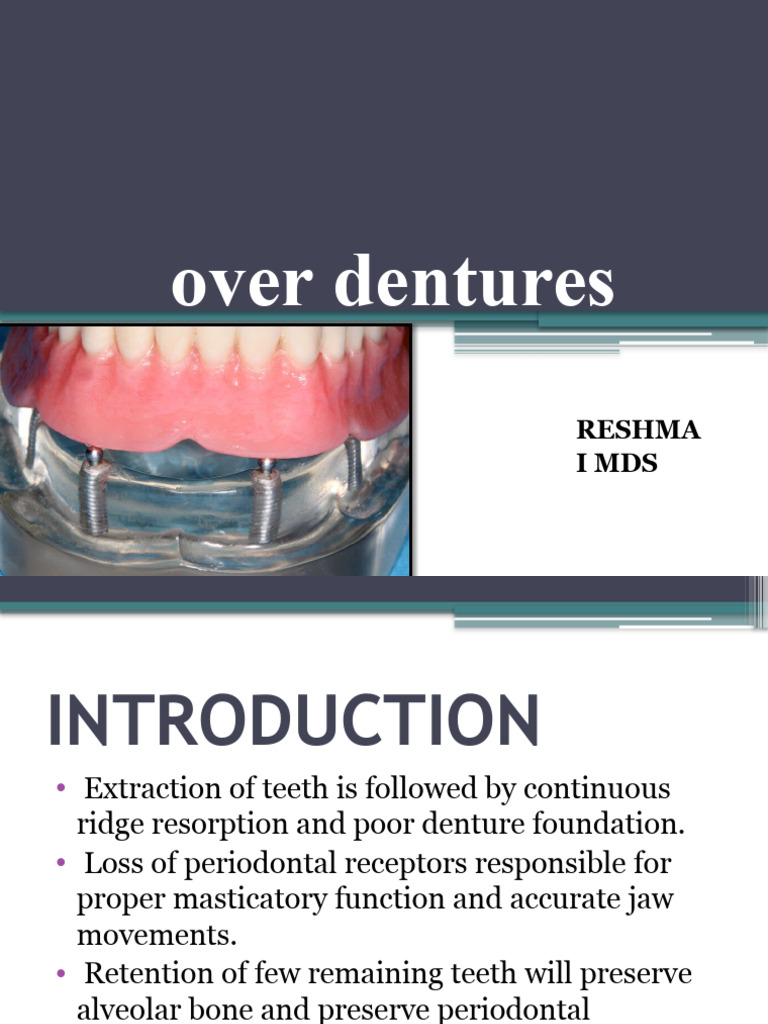 Over Dentures | Download Free PDF | Dentures | Dental Implant