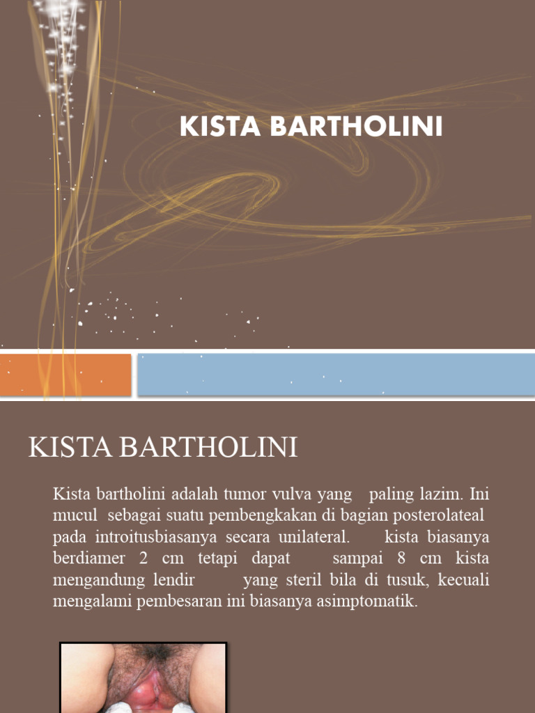 Kista Bartolin - Dila R. | PDF