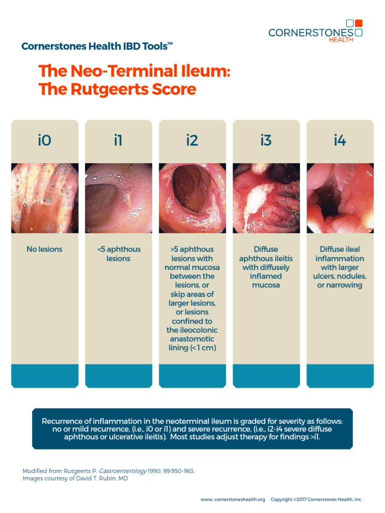 The Neo Terminal Ileum The Rutgeerts Score | PDF
