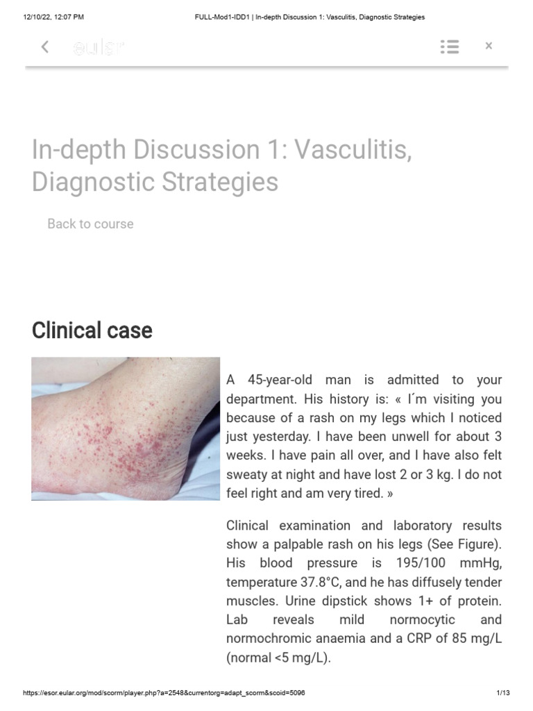 FULL-2225_ IDD1_ Vasculitis, Diagnostic Strategies | PDF | Causes Of Death | Medicine