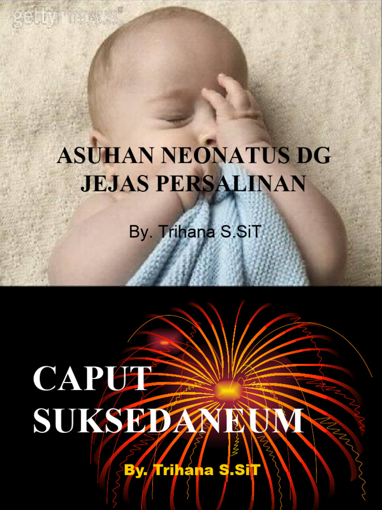 PERSALINAN | PDF