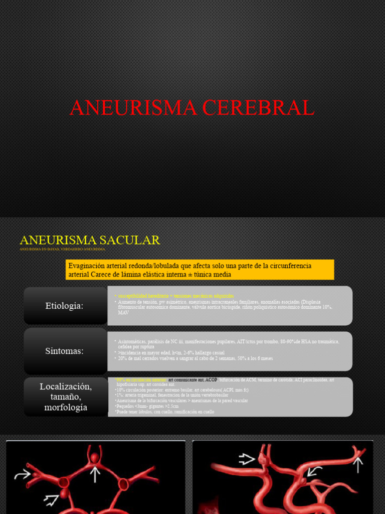 Aneurisma Cerebral | PDF