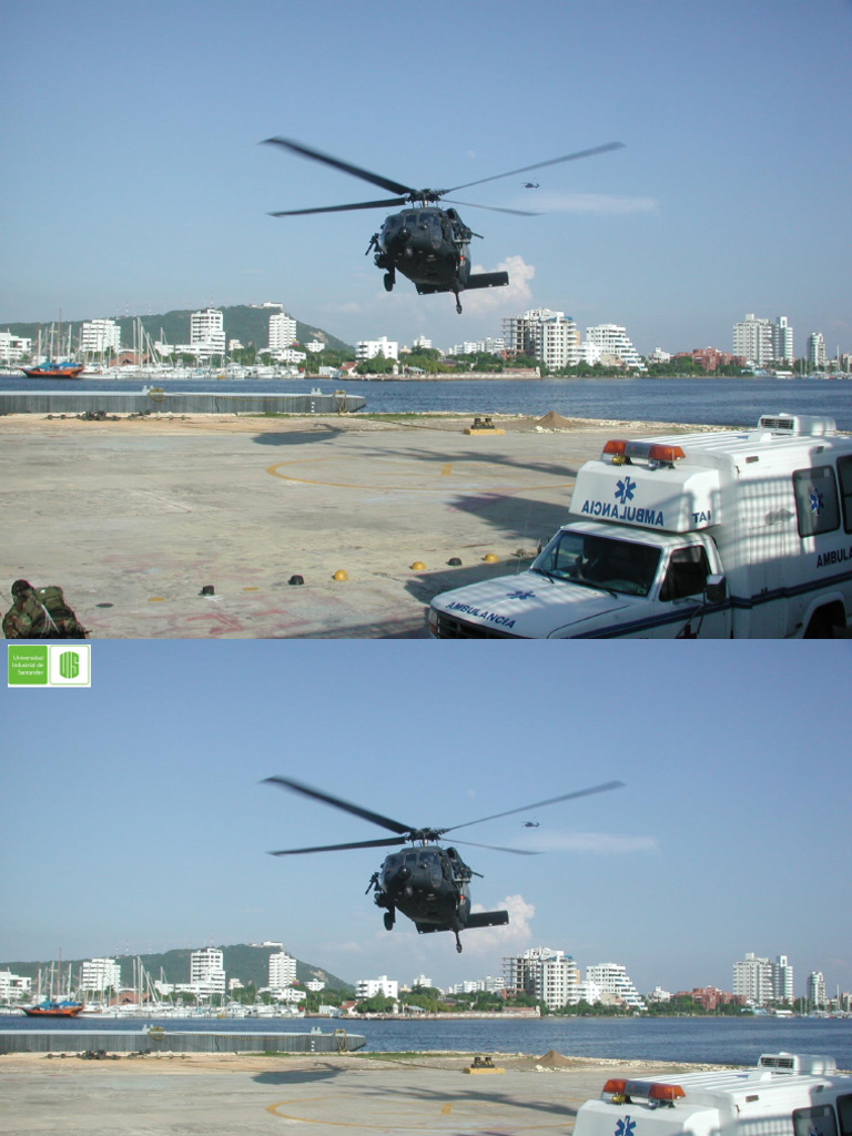 Manejo Inicial Trauma Atls 2014 | PDF