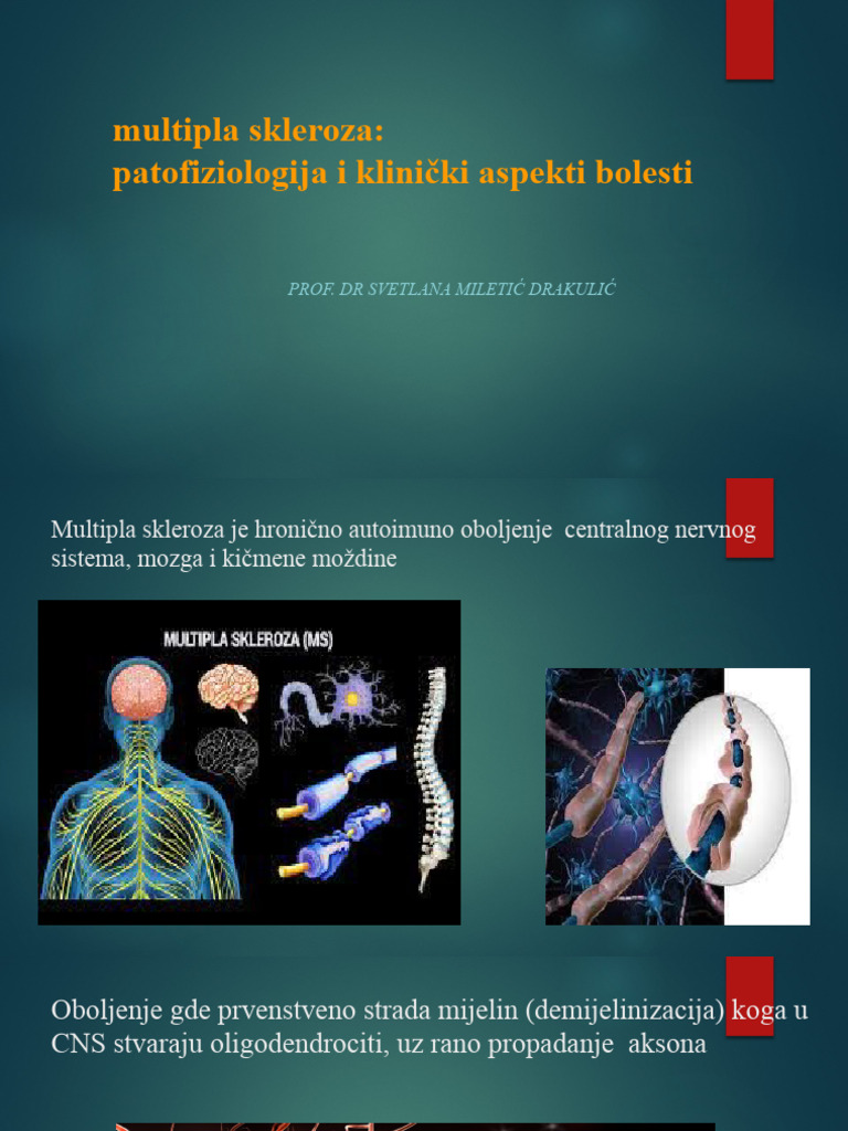 Predavanje Multipla Skleroza 8 | PDF