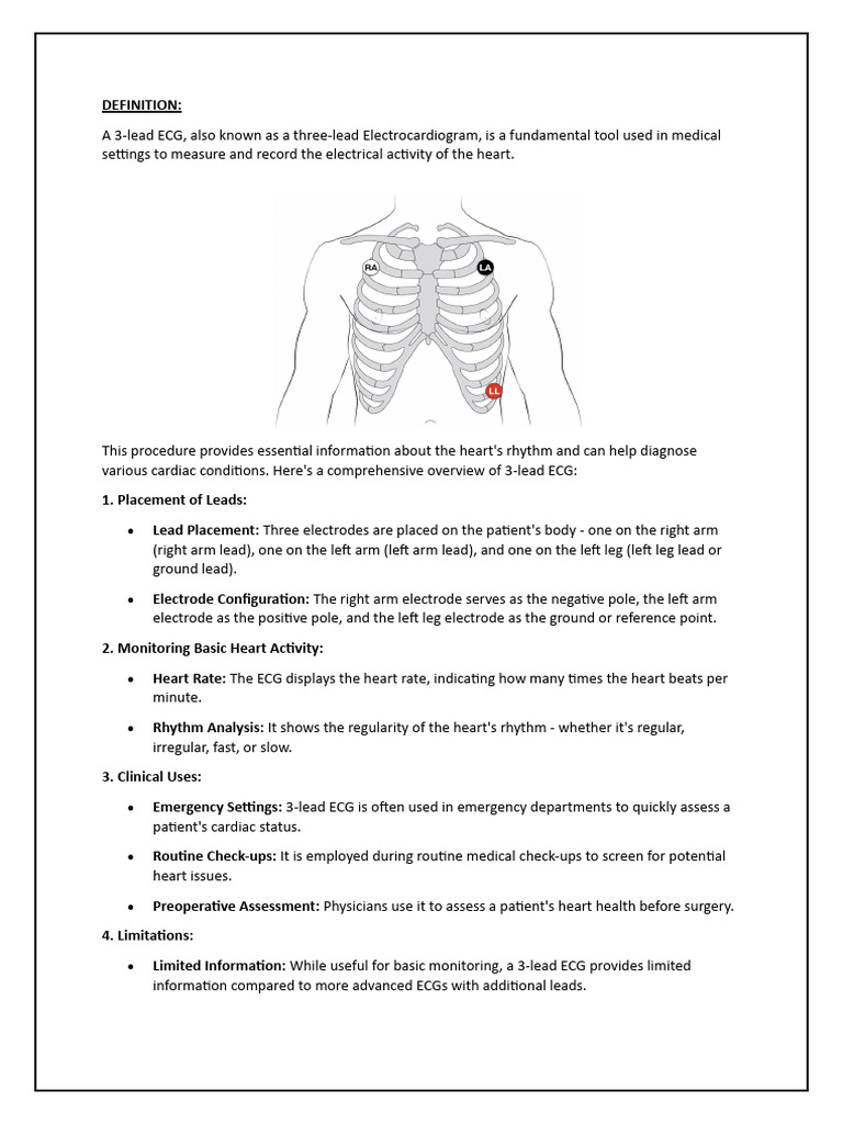 3 Lead Ecg | PDF