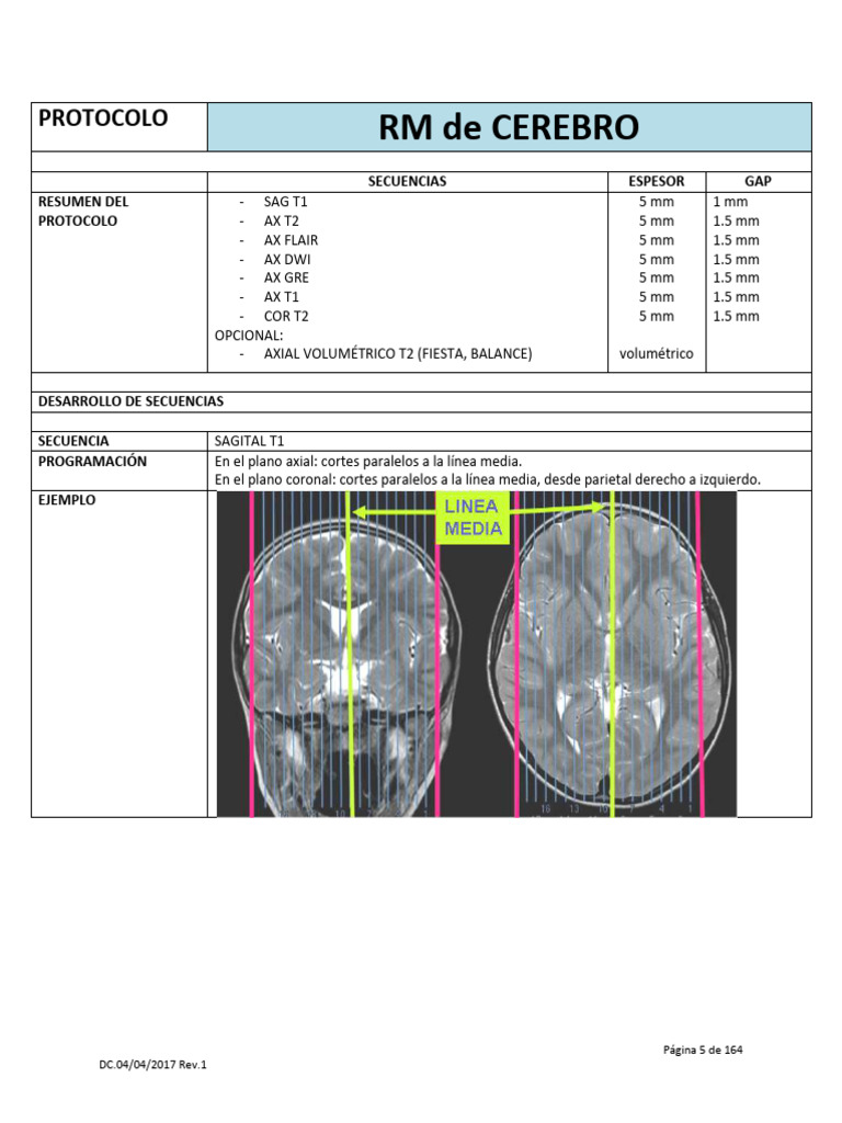 Manual de Resonancia - Protocolos Rev.1 04.04.17 | PDF