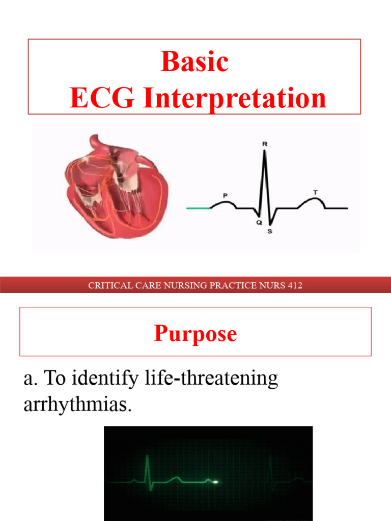 Basic ECG Interpretation | PDF | Electrocardiography | Heart