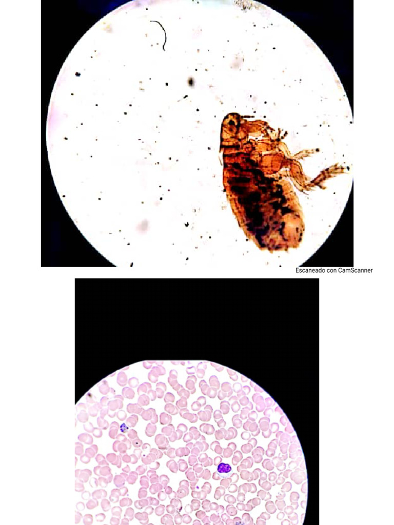 Reco Parásito | PDF