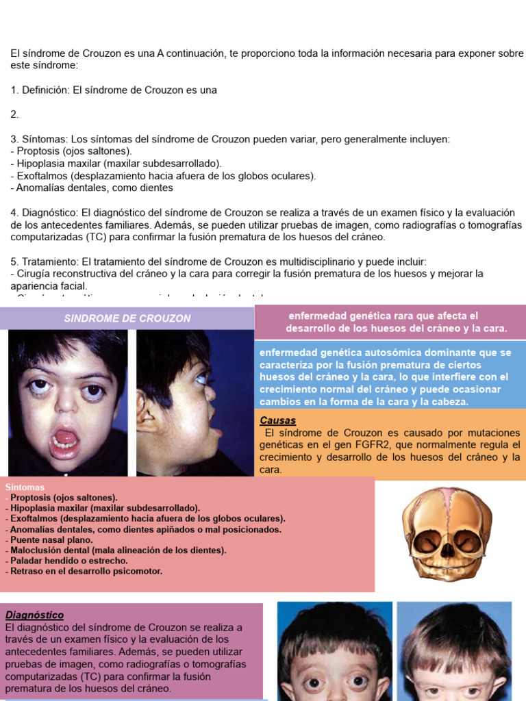 Sindrome de Crouzon | PDF