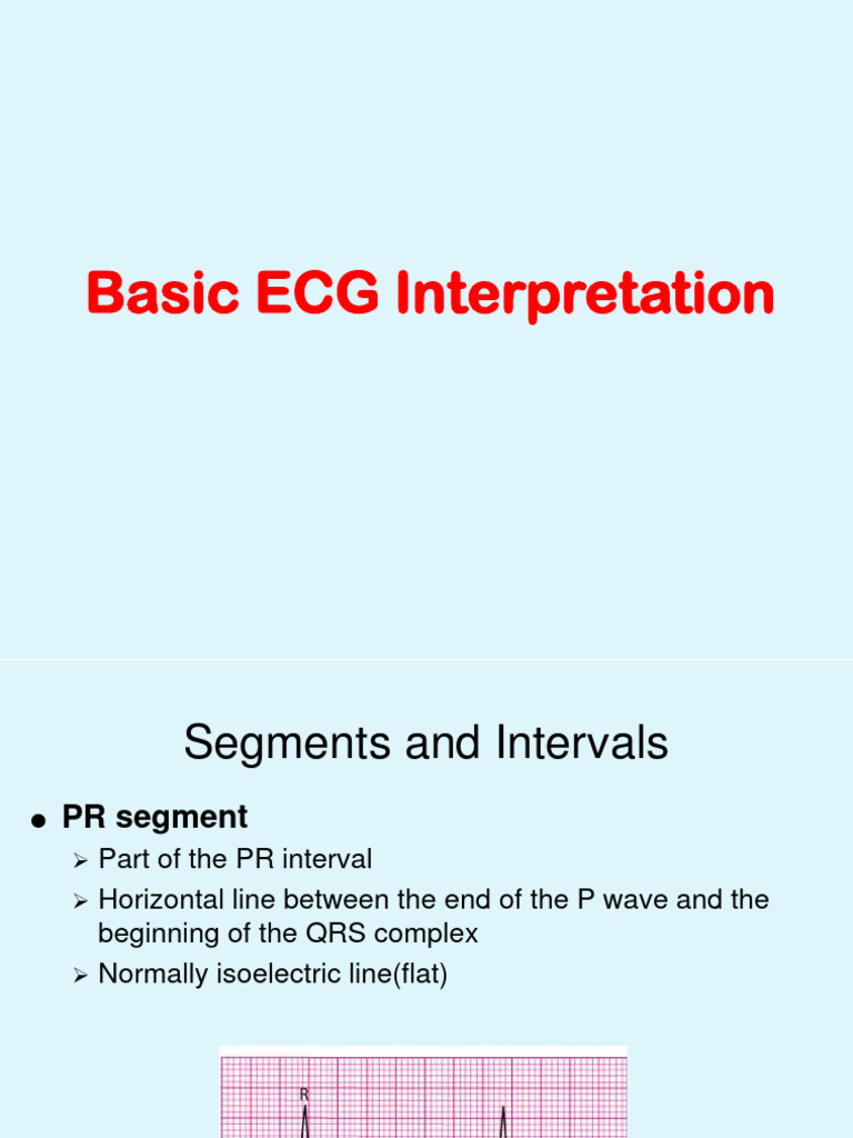 2 Basic ECG Interpretation | PDF