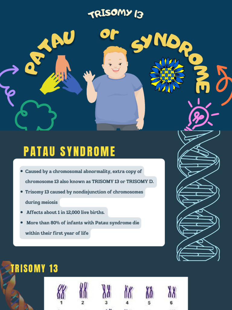 TRISOMY13 | PDF | Syndrome | Diseases And Disorders